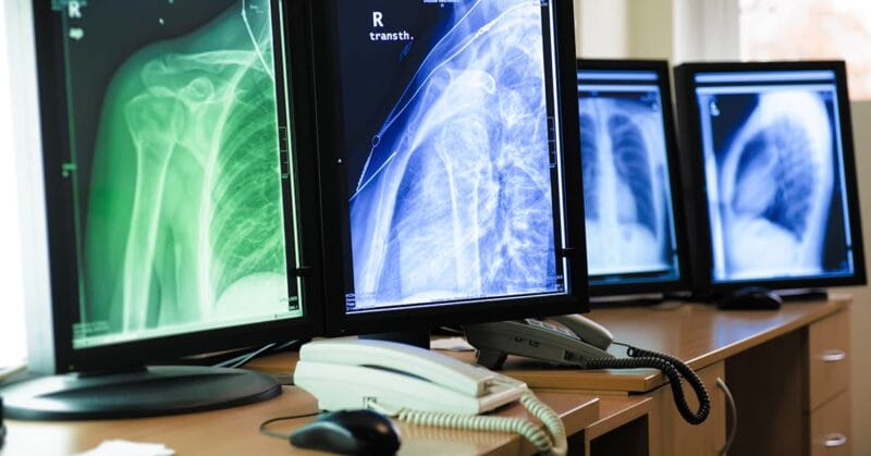 Raio X: Tipos de Exames e 08 Dúvidas Comuns