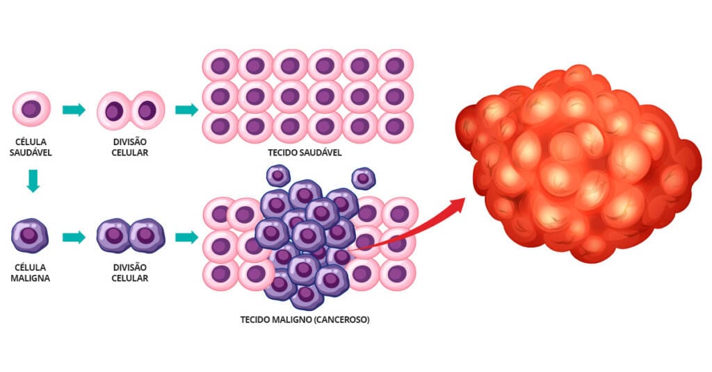 Câncer: o que é, tratamentos, prevenção e tendências